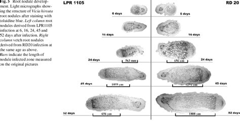 Root Nodule Development Light Micrographs Showing The Structure Of