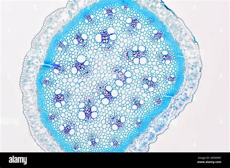 Xylem And Phloem Under Microscope