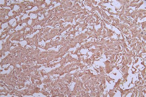 Anti Homo Sapiens Human Arg1 Recombinant Monoclonal Antibody Cusabio