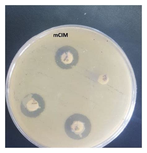The Results Of Mcim And Ecim A Mcim B Ecim Download Scientific Diagram