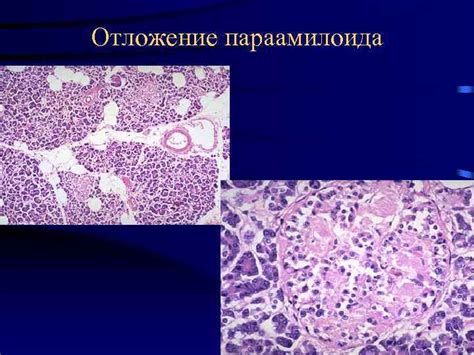 ГОУ ВПО УГМА Кафедра патологической анатомии БОЛЕЗНИ ЖЕЛЕЗ