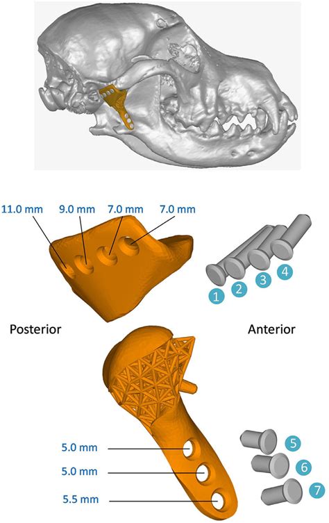 Assembly Diagram Of The Customized Tmj Prosthesis Top Panel Full View