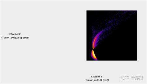 看完这篇，荧光共定位分析就没问题了！ 知乎