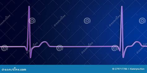 Electrocardiogram Ecg Displaying A Junctional Rhythm 3d Illustration