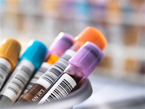 Anticoagulation Clinic Inr Lancet Laboratory