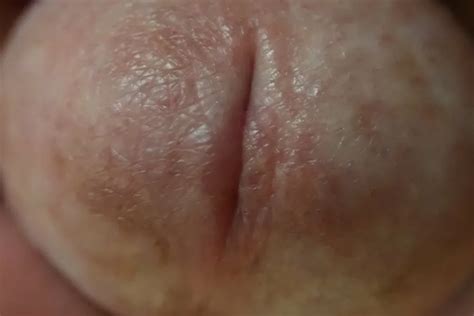 Close Up Penis Pics Xhamster
