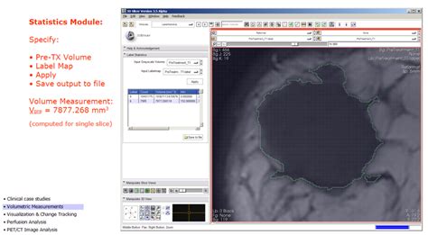 Slicer3 UIDesign WorkingProblems BCAnalysis Volumetric Slicer Wiki
