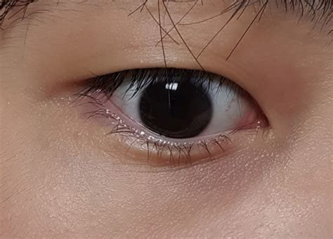 눈 다크서클 없애는 법 지식in