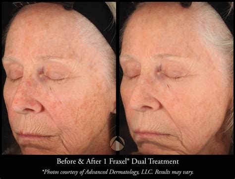 Untitled Advanced Dermatology Flickr