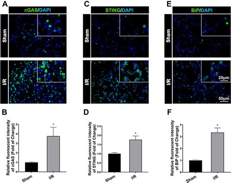 Inhibition Of The Cgas Sting Pathway Attenuates Lung Ischemiareperfus