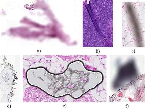 Examples Of Artifacts From The Considered Datasets A Focus B