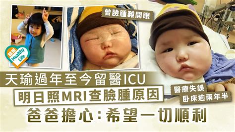 集氣祝福︳過年至今仍留醫icu 7歲天瑜將照磁力共振 查臉腫原因腫瘤有否復發 晴報 健康 腫瘤及癌症 D230207