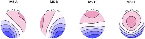 Microstate Normative Maps Ms A Microstate A Ms B Microstate B