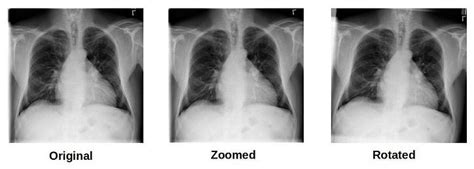 Augmentasi Data Di Gambar Medis