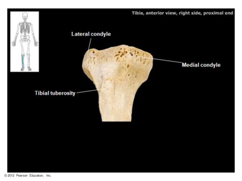 Lower Limb Bones Tibiafibula Landmarks Flashcards Quizlet