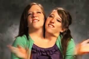 Conjoined Twin Abby Hensel Is Married
