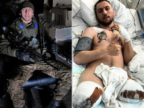 A Ukrainian Commander Lost His Legs This Story Is About Love Through Adversity The Picture