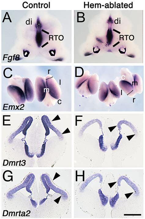 Figure 7 From The Cortical Hem Regulates The Size And Patterning Of