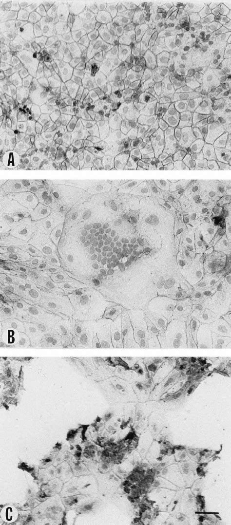 Differentiation Of Villous Trophoblasts As Measured By Intercellular