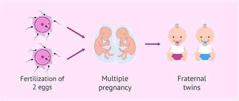 Twin Pregnancy Stages