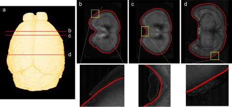 The Resistance Of Signal Interference During The Reconstruction A Download Scientific