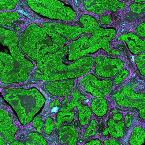 GeoMx Digital Spatial Profiler NanoString