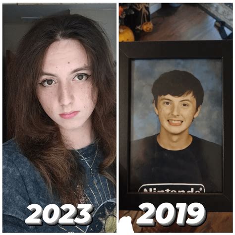 Now With More Hip Mtf Age 20 11 Months Hrt Rtranstimelines