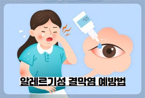 눈 간지러움 이물감 눈충혈 알레르기성 결막염이 의심된다면