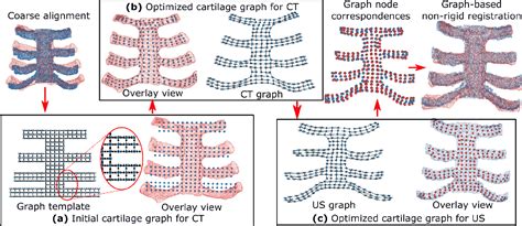 Thoracic Cartilage Ultrasound Ct Registration Using Dense Skeleton