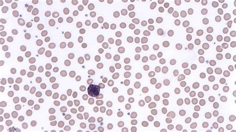 Basophils Definition Function Causes Of High And Low Count