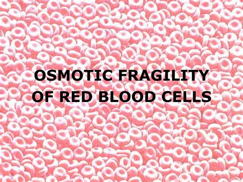 Osmotic Fragility Of Red Blood Cellsppt Free Download