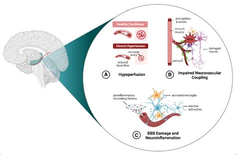 Summary Of How Pathological Conditions Known To Accelerate Age Related Download Scientific