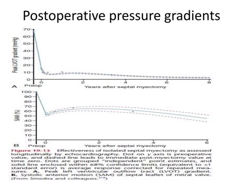 Hypertrophic Obstructive Cardiomyopathy Pptx