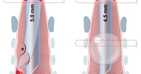 아주대병원 채윤정·김중헌 교수 소아응급환자 기관 내 삽관 ‘공기주머니 있는 튜브 권고