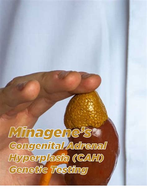 Minagenes Congenital Adrenal Hyperplasia Cah Genetic Testing Medicalprof