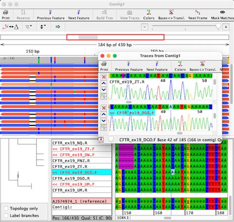 Sequence Alignment Software Codoncode Aligner For Dna Analysis