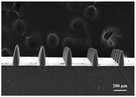 Preparation Of Microneedle Array Mold Based On Mems Lithography Technology
