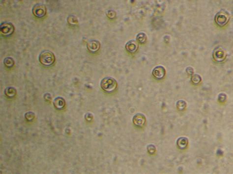 Cryptococcus Neoformans Culture