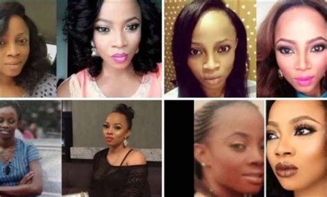 Skin Bleaching Side Effects Warnings And Safer Alternatives Greener