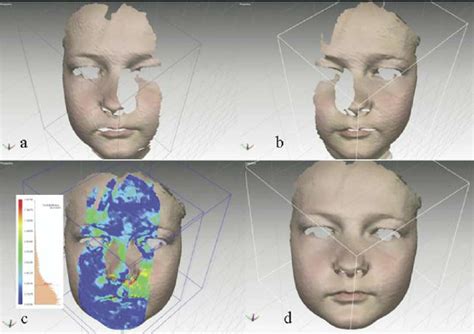 A Right Scan B Left Scan C Shell Deviation Color Map Blue Download Scientific Diagram