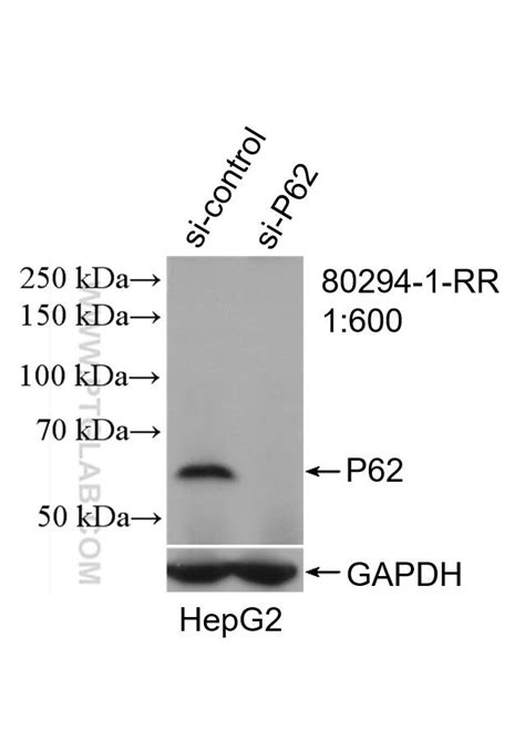 P62sqstm1 Antibody 80294 1 Rr Proteintech