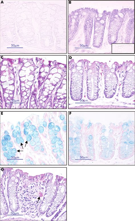 A B In Situ Hybridisation Analysis Of Peroxisome Proliferator