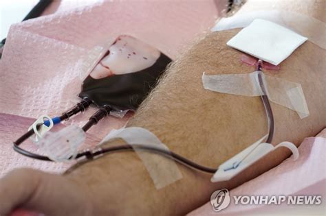 코로나로 혈액 부족미 Fda 성소수자 남성 헌혈 허용확대 나무뉴스