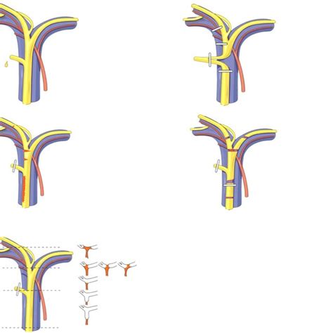 Stewart Way Classification 15 Download Scientific Diagram Stewart Way Classification 15 Download Scientific Diagram