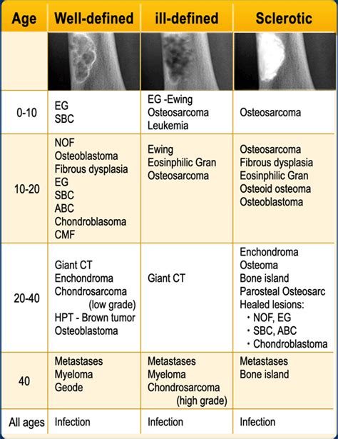 The Radiology Assistant Bone Tumors Differential Diagnosis
