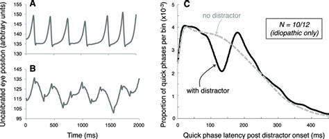 Example Waveforms From A Unidirectional Jerk Nystagmus Participant