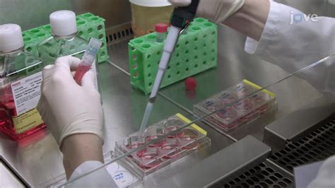 Video Monitoring The Arrival Of Gfp Tagged Surface Proteins To The