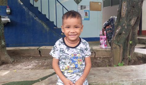 Maung Win From Burma Raised 1500 To Prevent Infection In Pelvic Burns