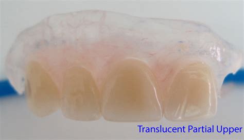 Partial Dentures Dentucare