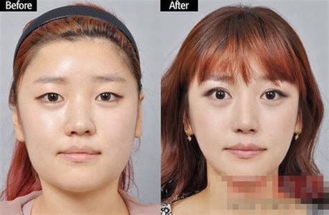韩国整容节目大变身 歪嘴女屌丝变白富美新浪图片